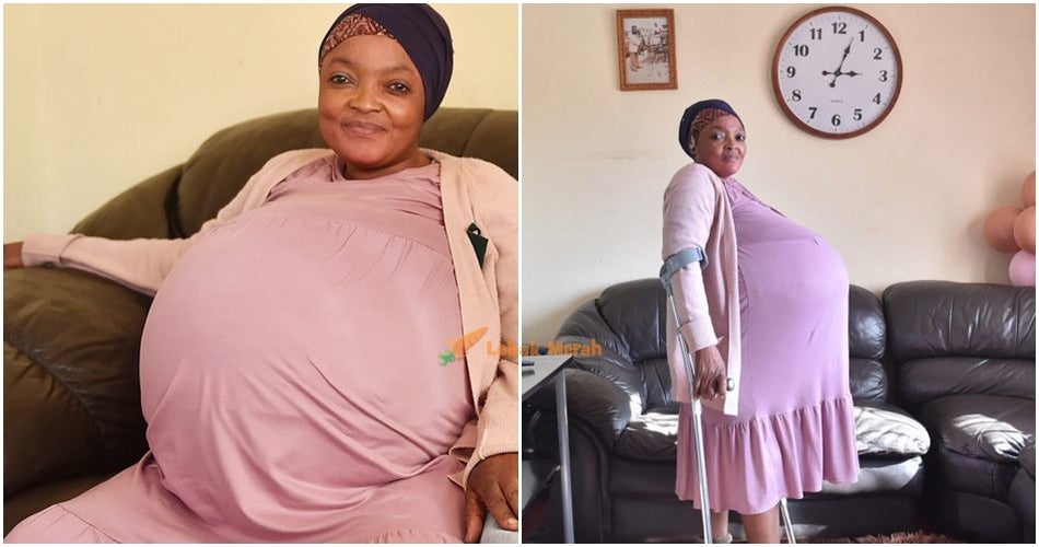 Scan Dapat Kembar 8, Tapi Lepas Bersalin Rupanya kembar 10 - Lobak Merah