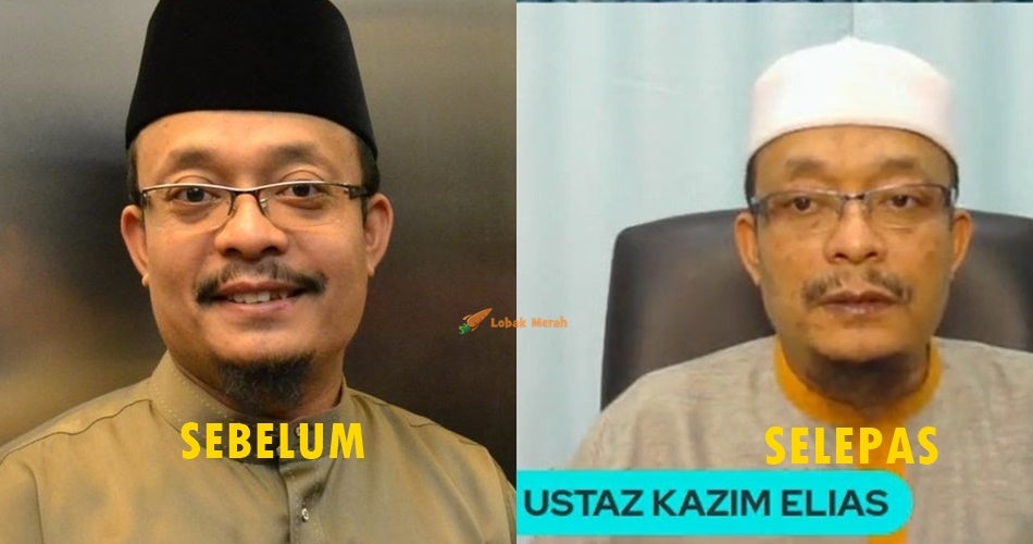 "Habis bibir jadi hitam" - Ustaz Kazim Elias Kongsi 'Perubahan' Terbaru, Dakwa Kena Penyakit ...