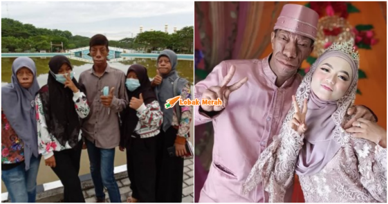 Kenali Keluarga Surya Manurung, Hidap Sindrom Pelik Hingga Ubah Bentuk ...