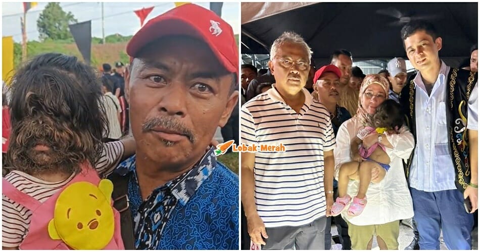"Pesan jaga Missclyen dengan baik" - Bapa Budak Hidap Sindrom Werewolf ...