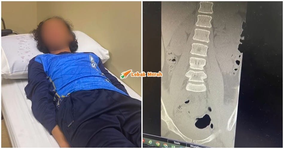 Angkara Kawan Bergurau Tarik Kerusi, Ibu Kecewa Anak Istimewa Patah Tulang Belakang - Lobak Merah