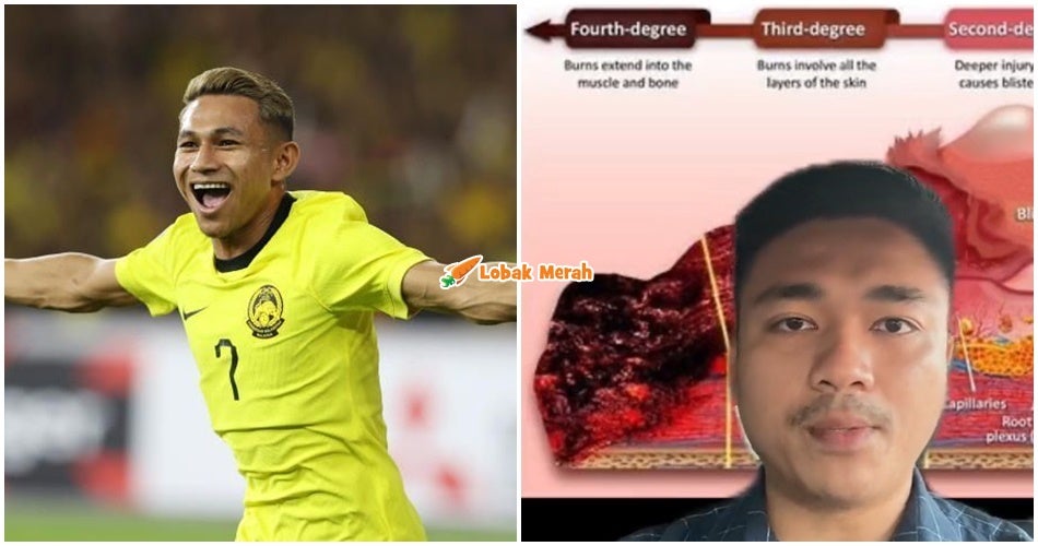 Doktor Beri Gambaran Kecederaan Faisal Halim, Ini Yang Dimaksudkan ...