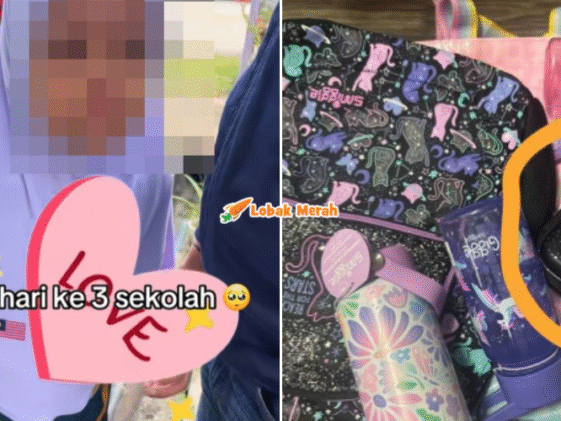 "Melecur kalau kena gigit" - Ini Cara Merawat Kesan Gigitan Semut ...